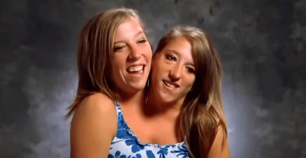 Conjoined Twin Abby Hensel Quietly Married In 2021