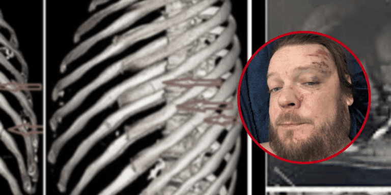 Corey Harrison, Of 'Pawn Stars,' Injured In Motorcycle Crash